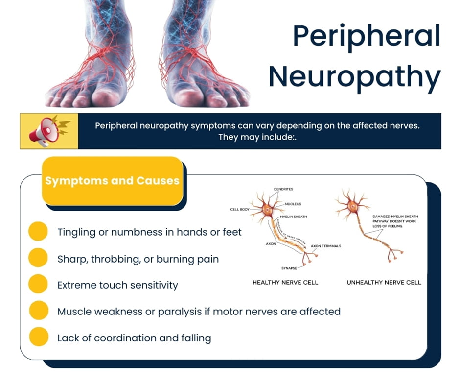 Peripheral Neuralgia nyc NYC | Peripheral Neuropathy Doctors Peripheral Neuralgia nyc NYC | Peripheral Neuropathy Doctors